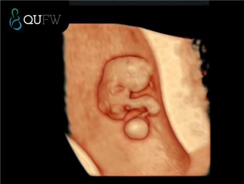 Pregnancy Ultrasound - QUFW
